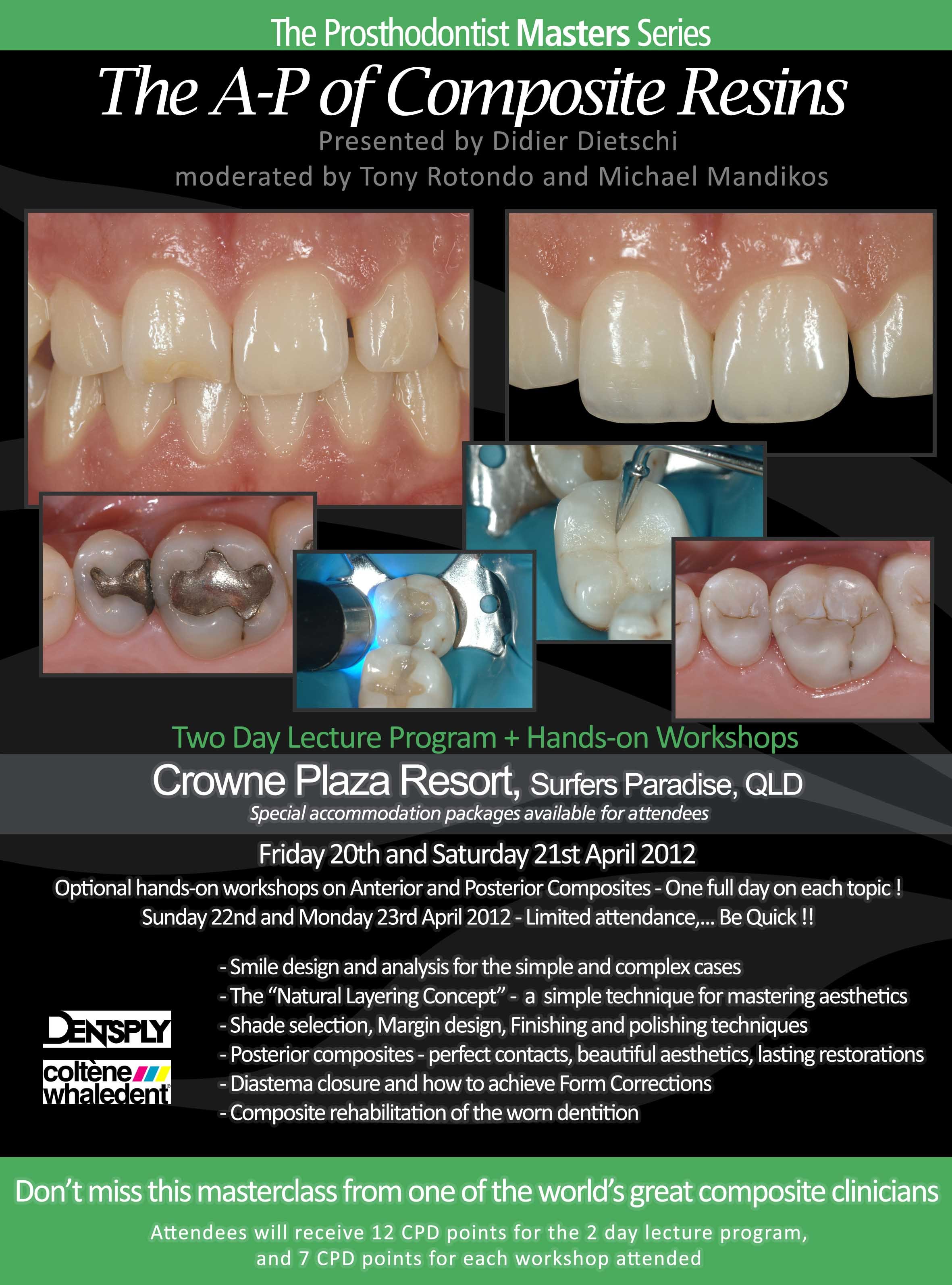 The A-P of Composite Resins 2012 | CeoDental