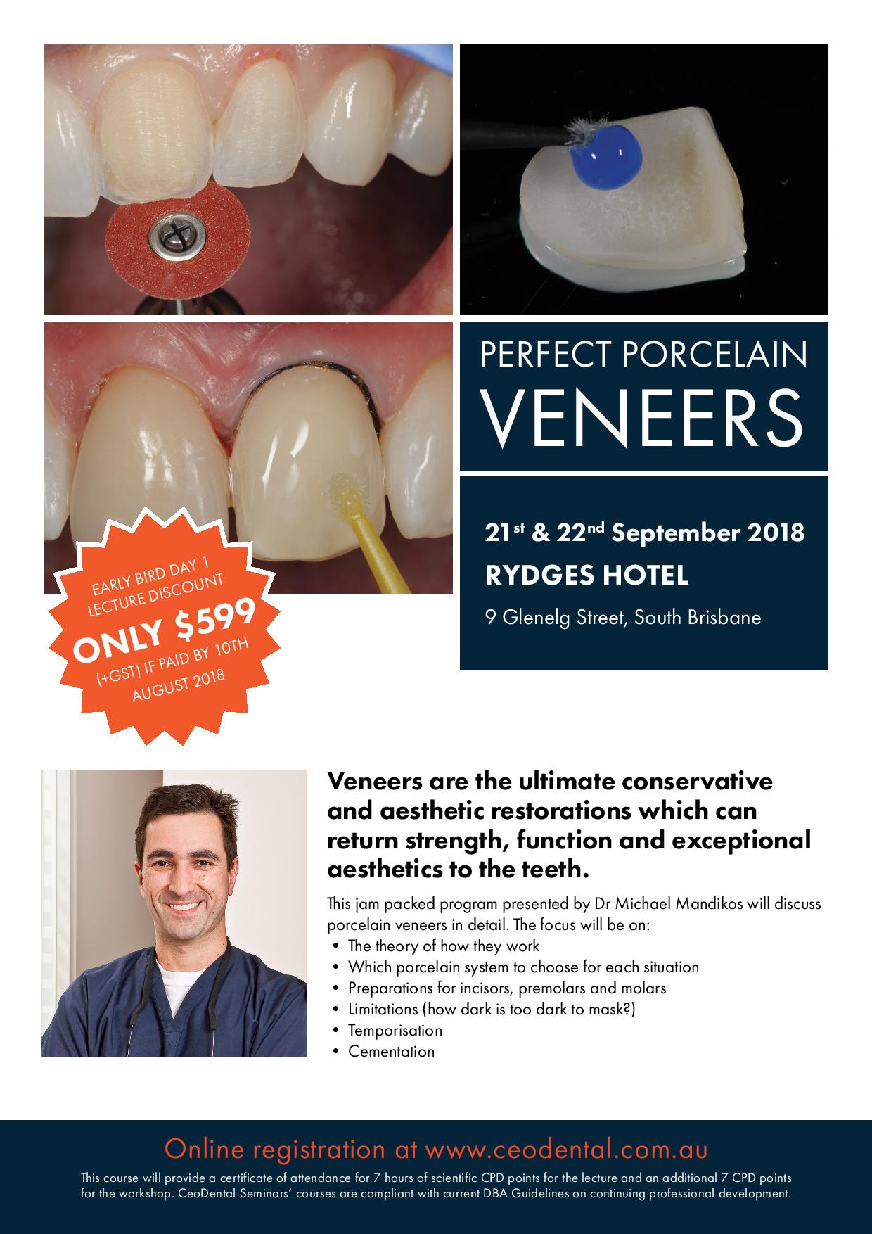 Perfect Porcelain Veneers lecture | CeoDental