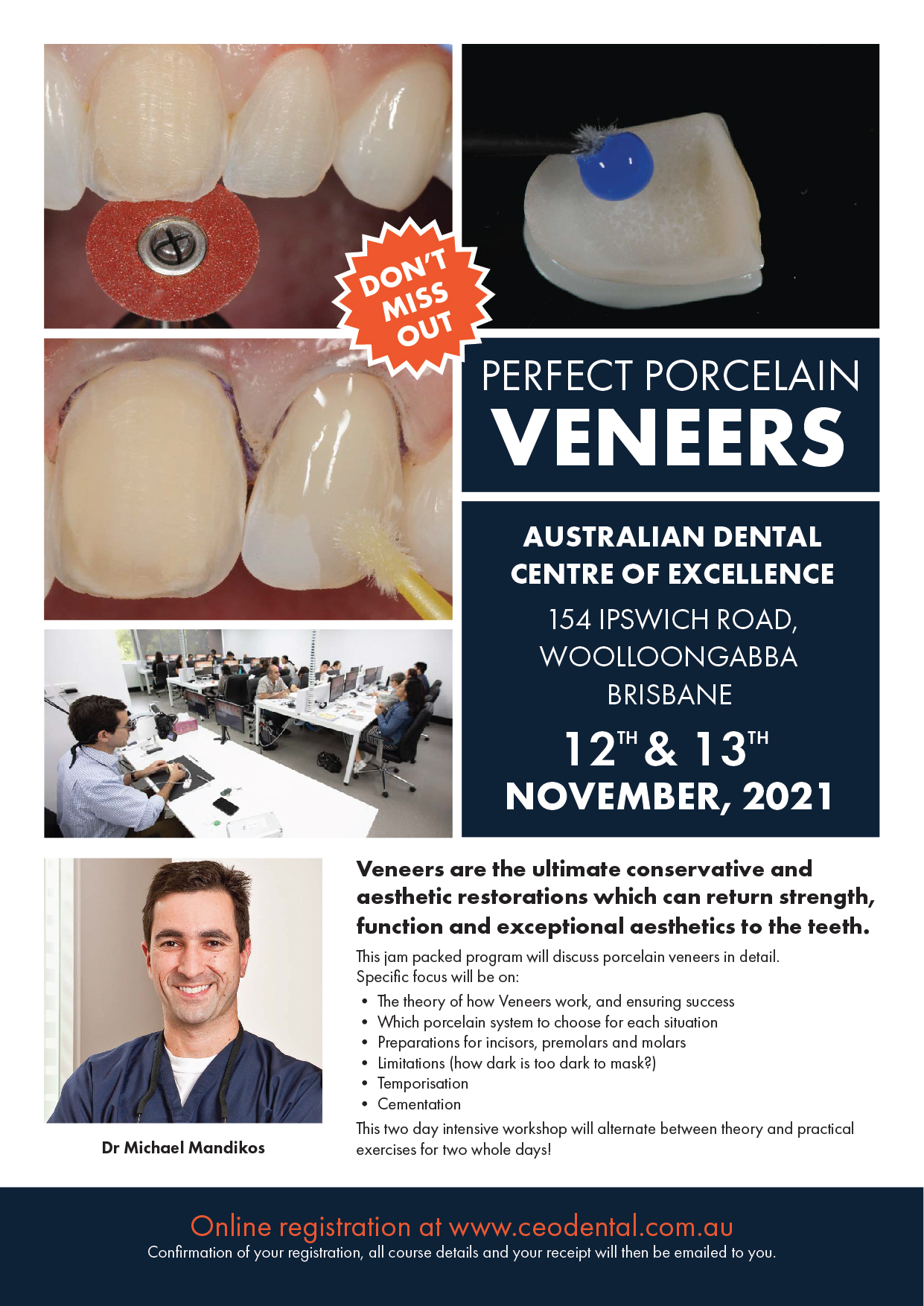 Perfect Porcelain Veneers 2021 | CeoDental