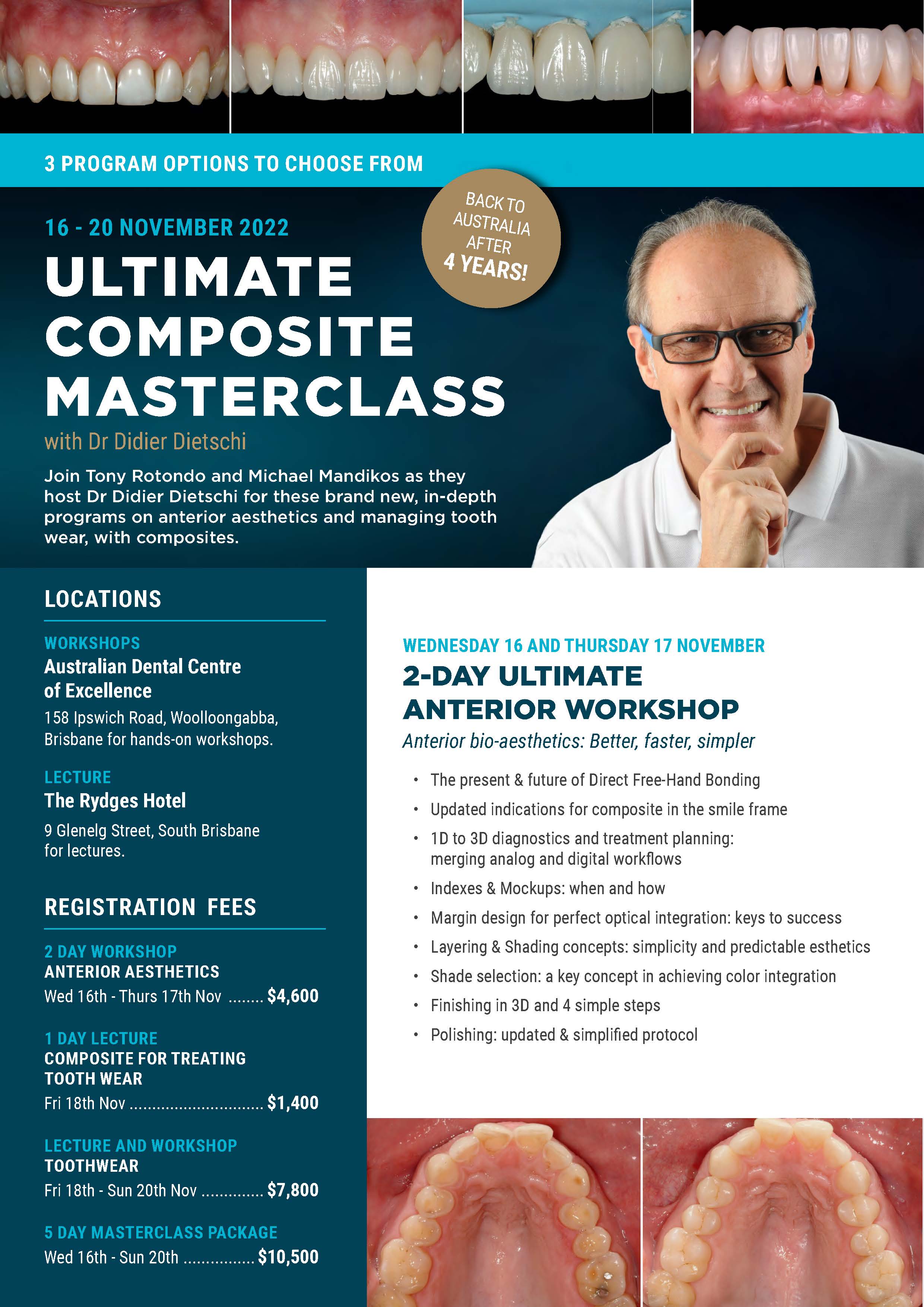 5 Day Masterclass PACKAGE, Anterior Aesthetics 2 day hands on, Tooth ...